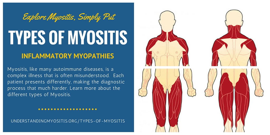 Types Of Myositis Myositis Support And Understanding Types Of Myositis Myositis Support And Understanding