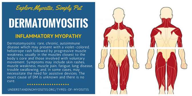 Dermatomyositis is a rare autoimmune disease - Myositis Support and ...